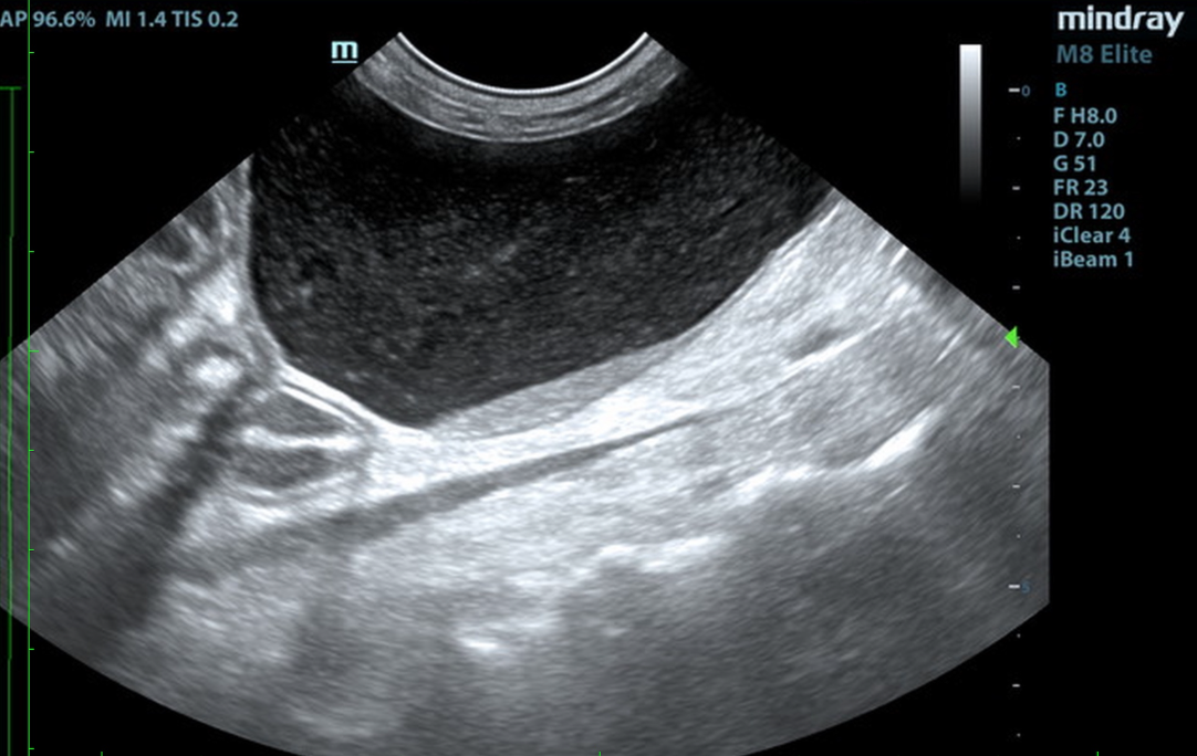 Mindray Elite 8 Image Gallery